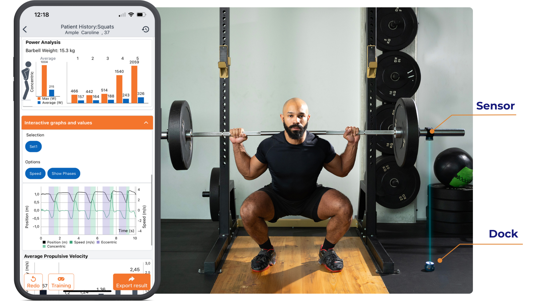 Velocity-Based Training (VBT): Definition, Benefits, VBT device